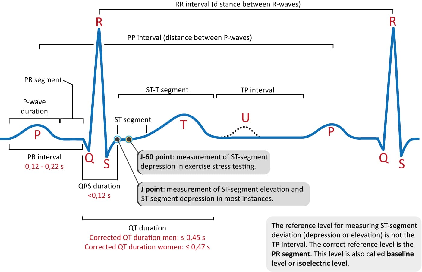 Interprétation de l’ECG : caractéristiques d’un tracé ...
