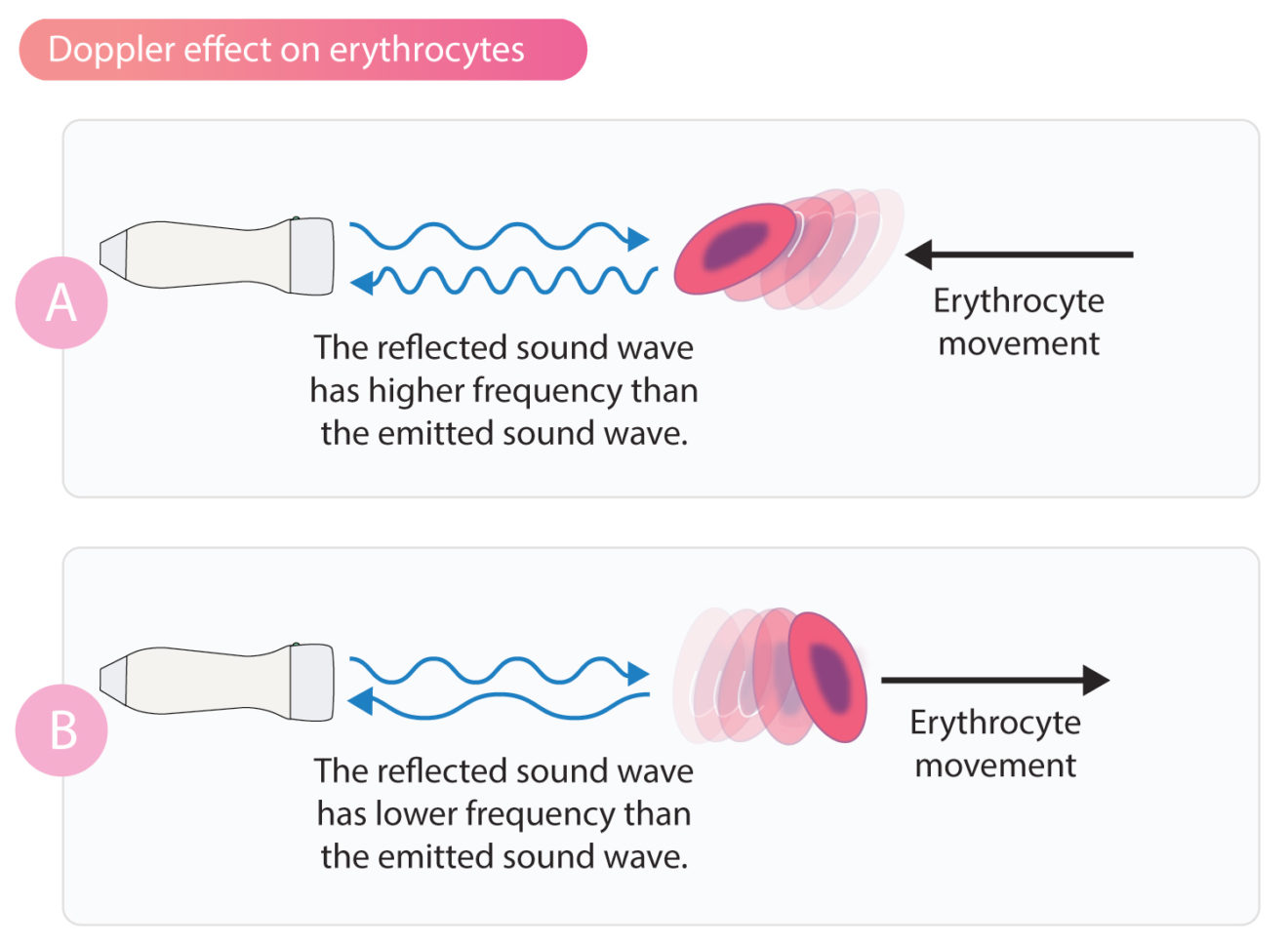 Effet Doppler et échocardiographie Doppler – Médecine Cardiovasculaire