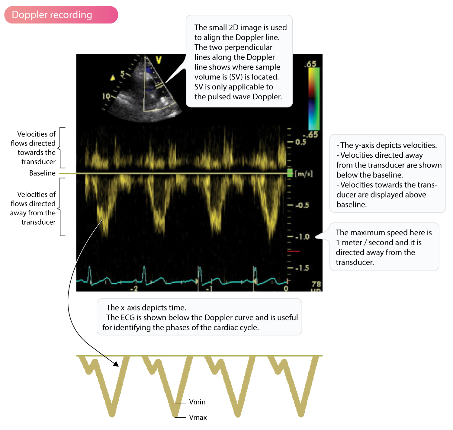 Effet Doppler et échocardiographie Doppler – Médecine Cardiovasculaire